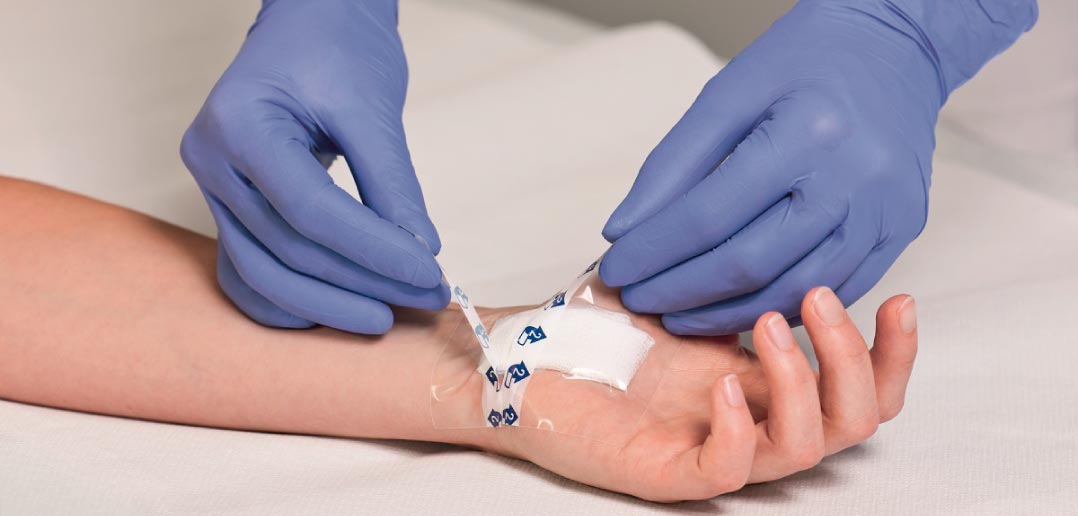 Heridas abiertas: definición, tipos y tratamiento - Meditip