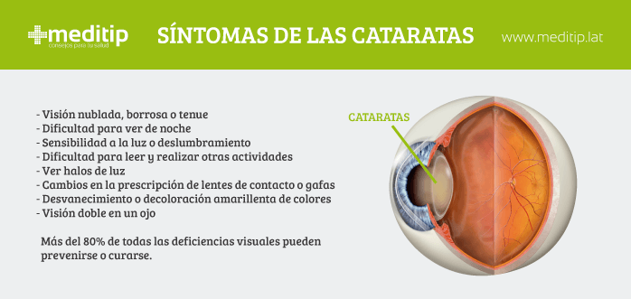 Cataratas: Tipos, diagnóstico y tratamiento - Meditip