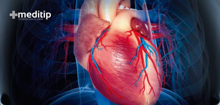 La enfermedad cardiaca en imágenes - Meditip