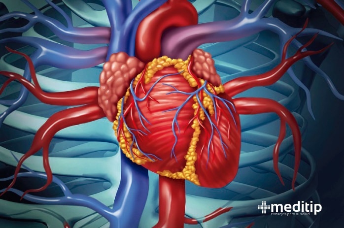 La enfermedad cardiaca en imágenes - Meditip
