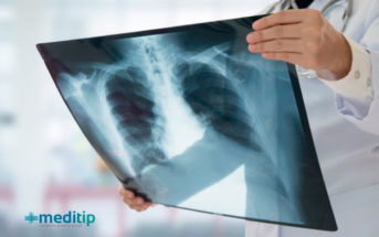 Hiperventilación: causas, síntomas y tratamiento - Meditip