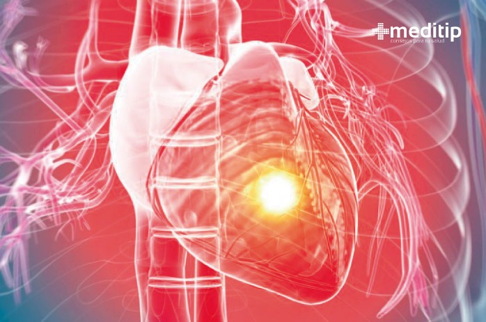 La enfermedad cardiaca en imágenes - Meditip