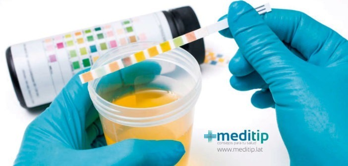 El color de la orina: qué dice de tu salud - Meditip