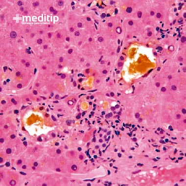 Bilis: un elemento esencial en la digestión de las grasas