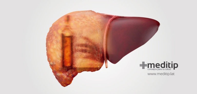 Función del hígado: síntomas de enfermedad hepática - Meditip