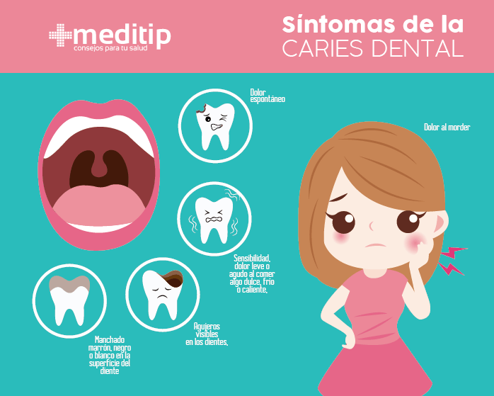 Caries dental: definición, causas y diagnóstico - Meditip