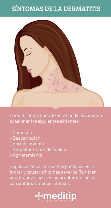 Dermatitis: tipos, causas y complicaciones - Meditip