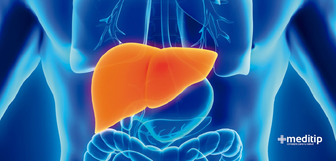 Hepatitis: causas, diagnóstico y tratamiento - Meditip