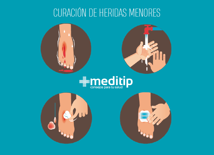 Cómo hacer la curación de una herida: manejo avanzado de heridas