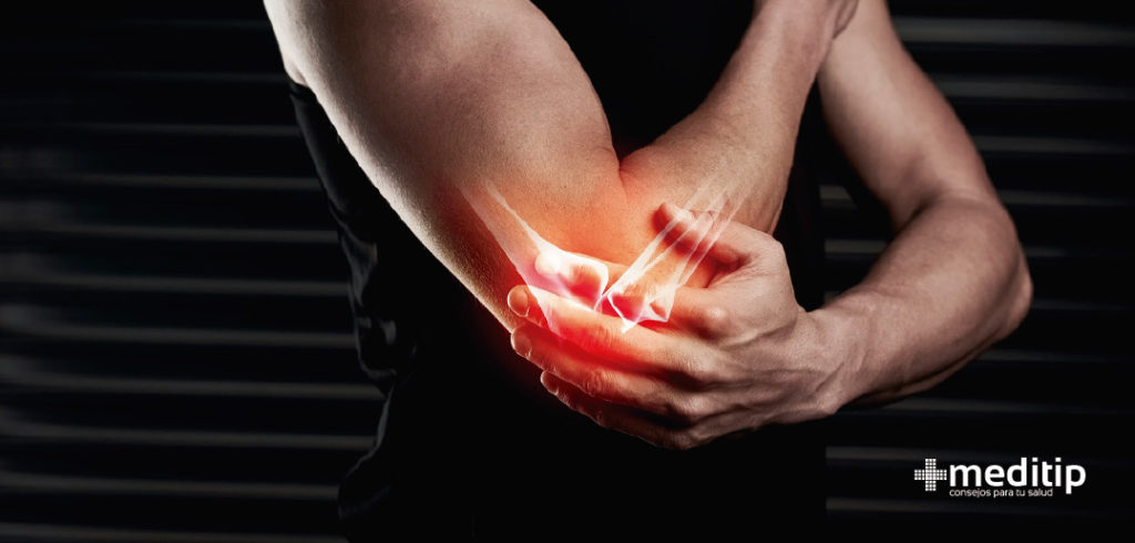 Dolor de codo: causas, diagnóstico y tratamiento - Meditip