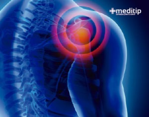 Dolor de hombro: causas, diagnóstico y tratamiento