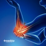 Dolor de codo: causas, diagnóstico y tratamiento - Meditip
