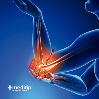 Dolor de codo: causas, diagnóstico y tratamiento - Meditip