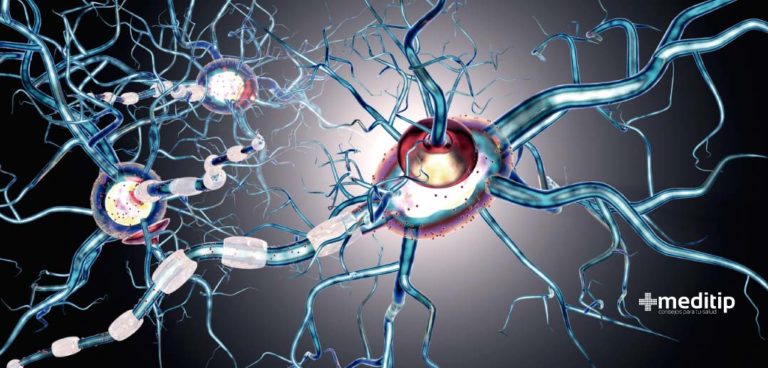 Esclerosis múltiple: causas, síntomas y tratamiento - Meditip