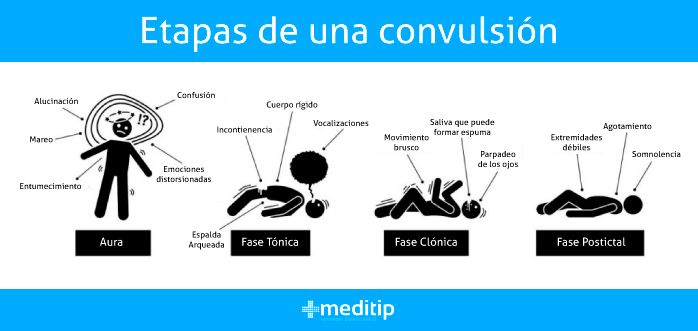 Fases De La Convulsión Tecnología Para El Control De La Epilepsia