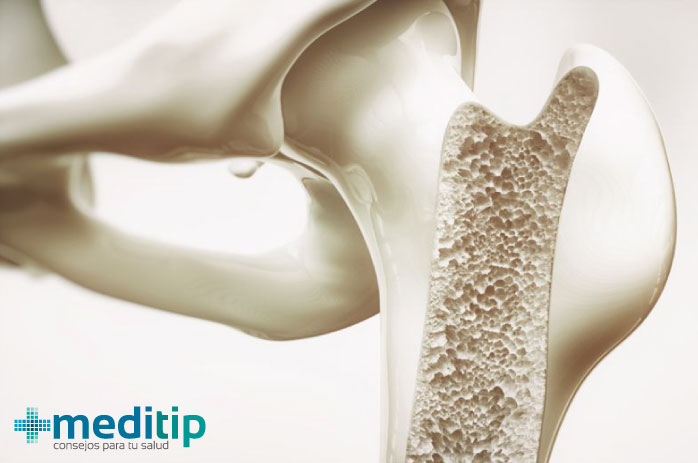 Envejecimiento y deterioro de huesos y músculos - Meditip