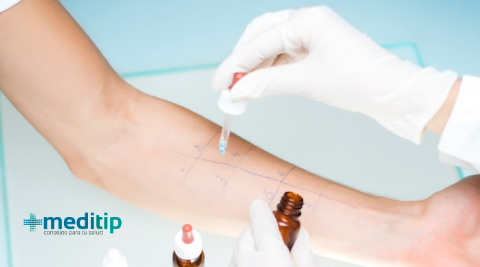 Tratamiento de la rinitis alérgica y no alérgica - Meditip