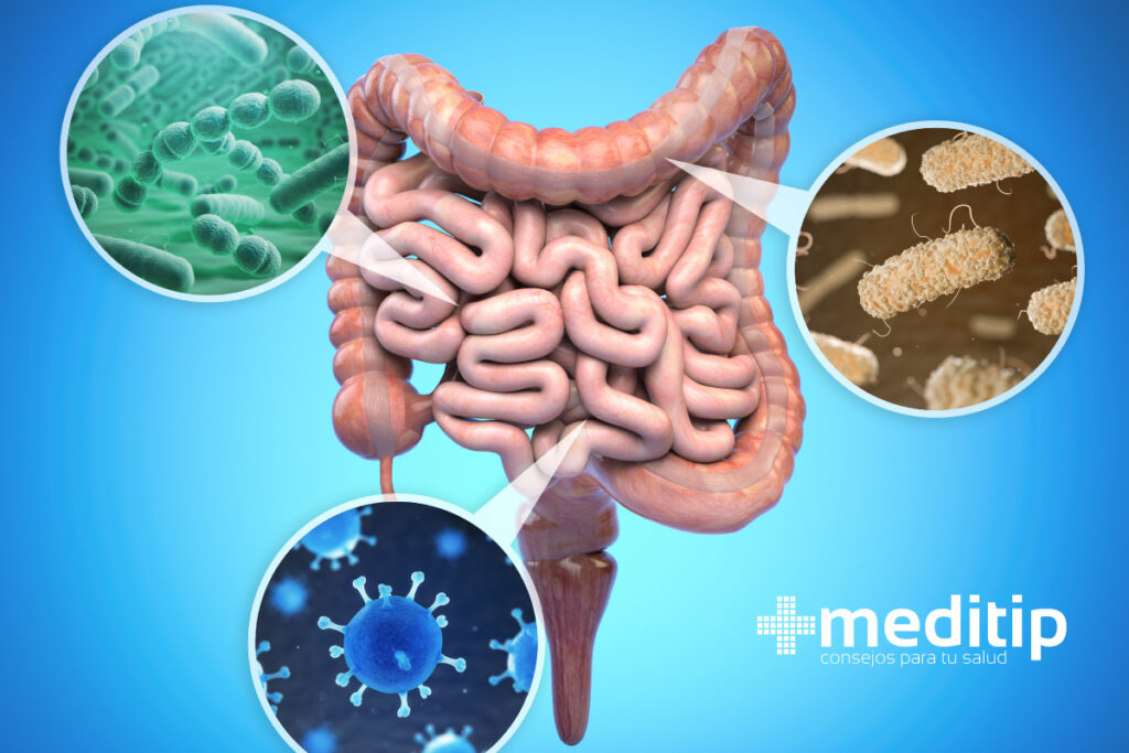 Disbiosis Intestinal: desequilibrio de bacterias en el intestino - Meditip