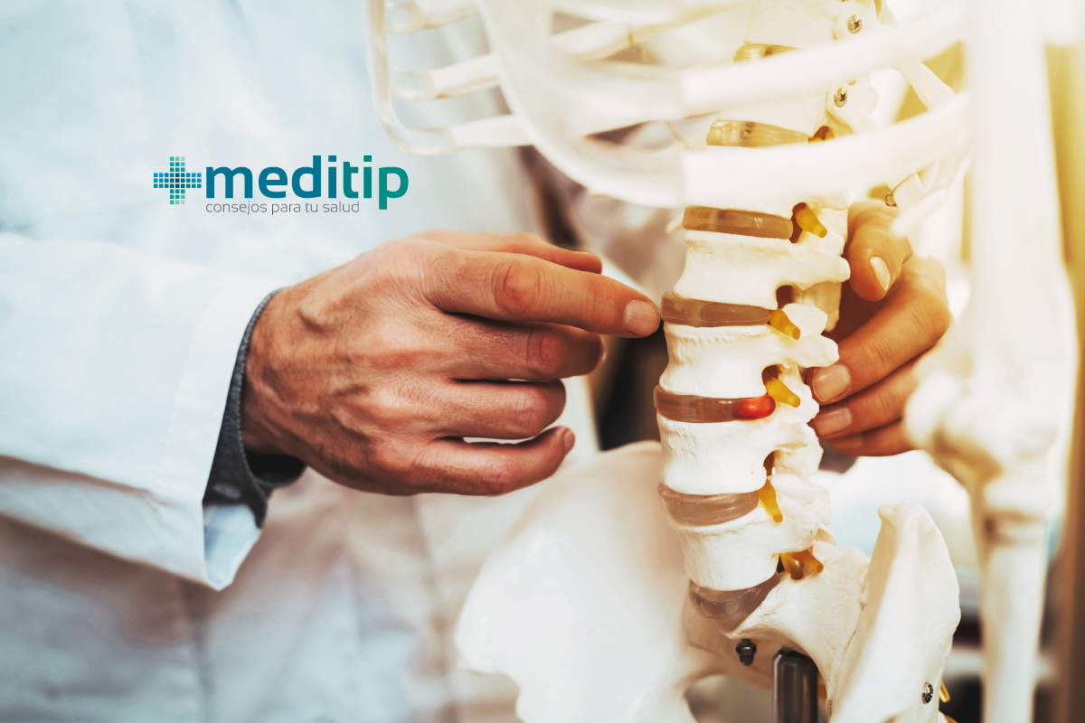 Las 10 preguntas más frecuentes sobre ortopedia