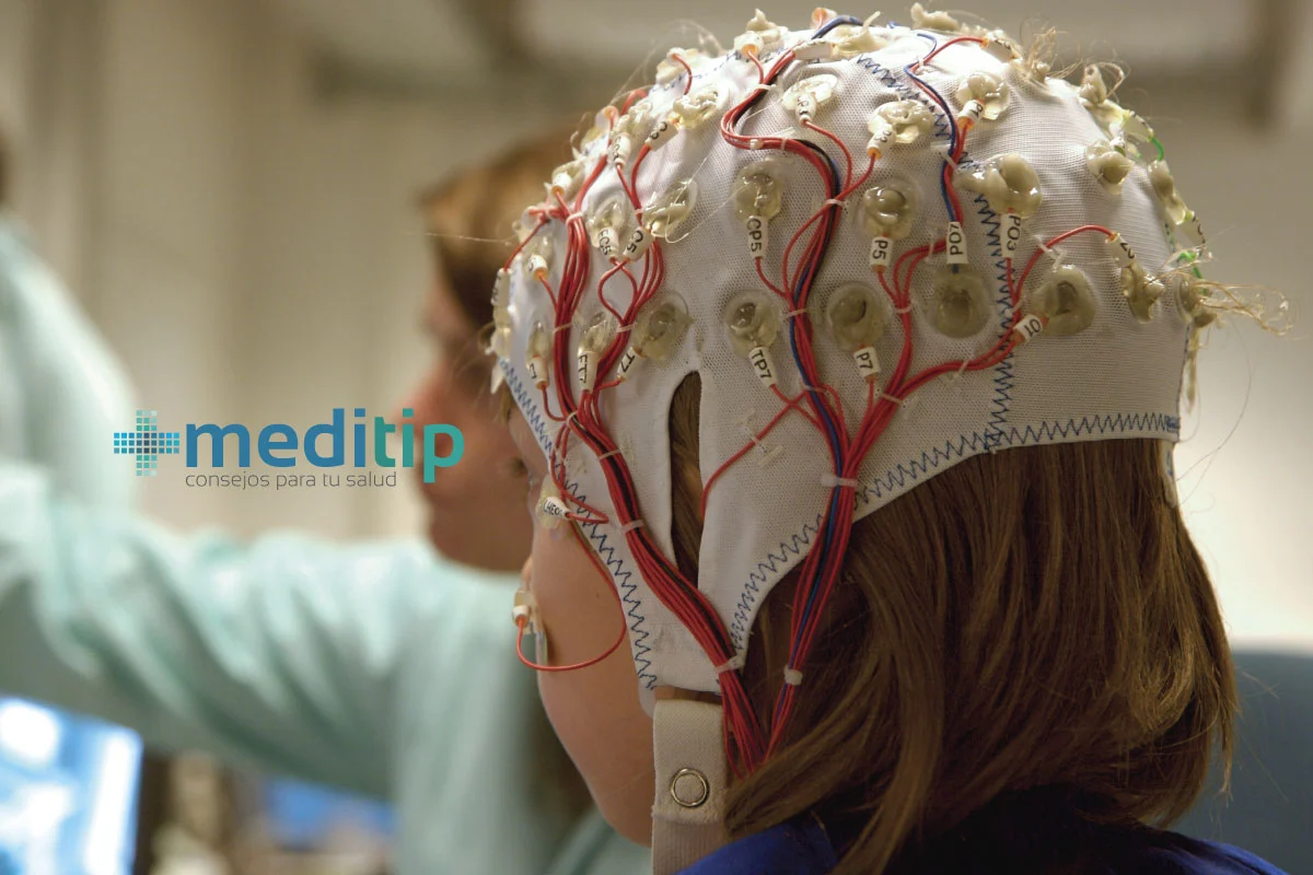 Epilepsia intratable en niños - Meditip