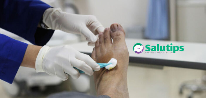 El lecho de una herida - Salutips