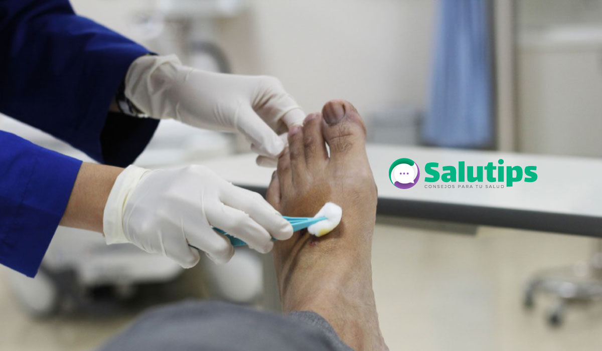 El lecho de una herida - Salutips