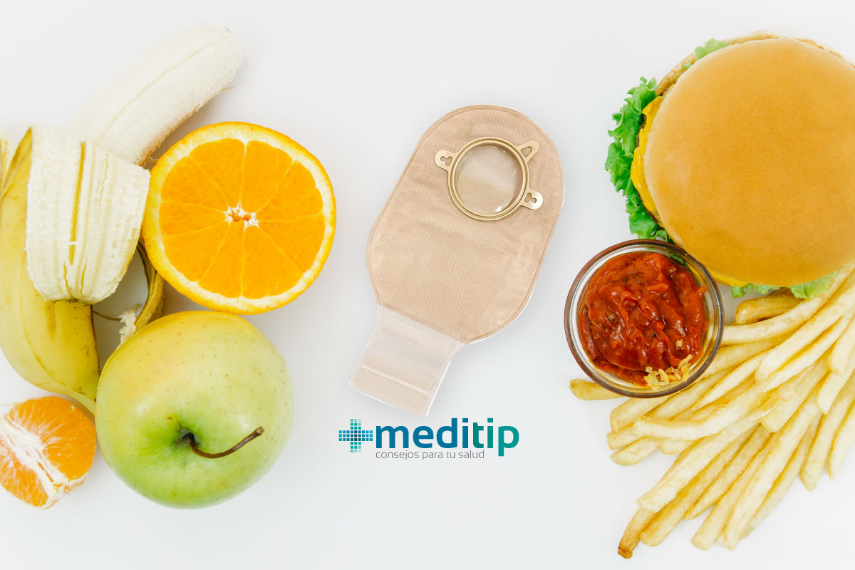Alimentación con una Ostomía - Meditip